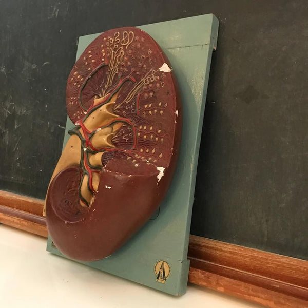 Vintage Anatomical Kidney Plaque – cityFoundry